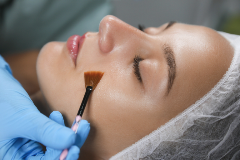 Treatment for Acne Scars | Infinity Medical Clinic | Marion, Iowa